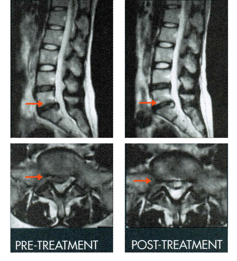 Pre and Post MRI’s – TriMed Spine & Joint